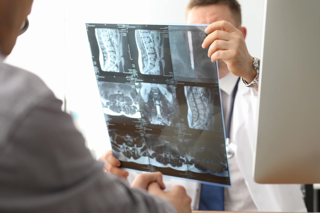 Herniated Disc Treatment in Kirkland, WA | Edward Jung, MD, MS